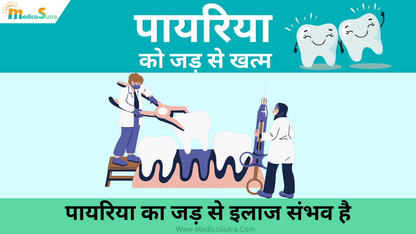 पायरिया को जड़ से खत्म करने का इलाज: 1 दिन में असर, दांत और मसूड़े ...