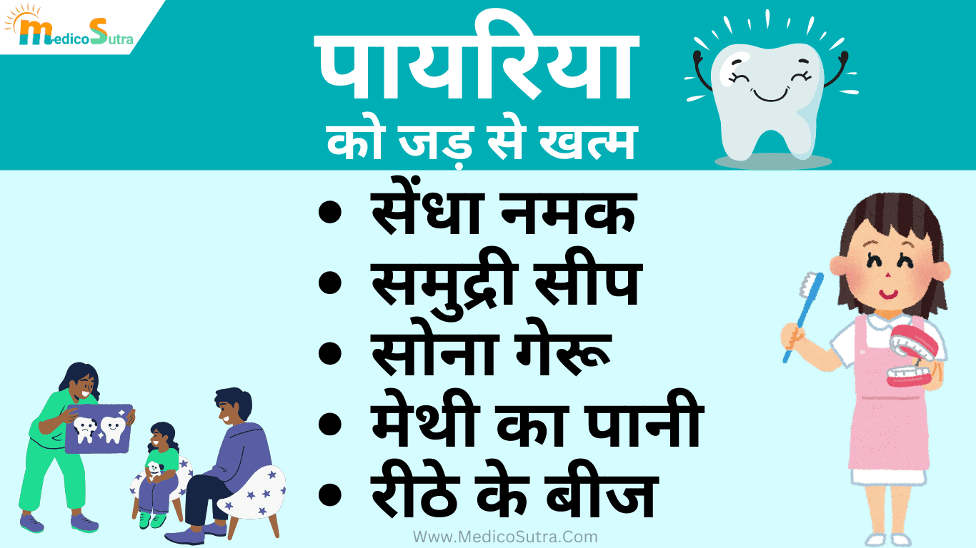 पायरिया को जड़ से खत्म करने का इलाज: 1 दिन में असर, दांत और मसूड़े ...
