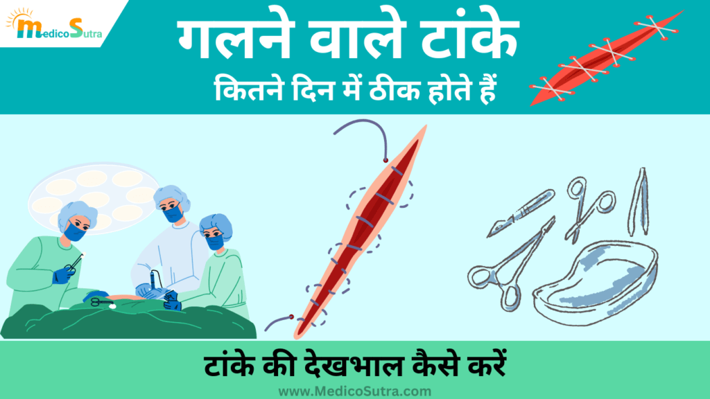 मानसिक तनाव कैसे दूर करें, मानसिक तनाव दूर करने के टिप्स और 15 अचूक ...